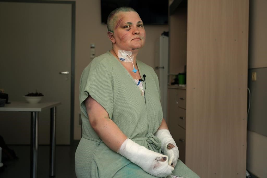 Russian journalist sustained a brain injury and fractures during a ...